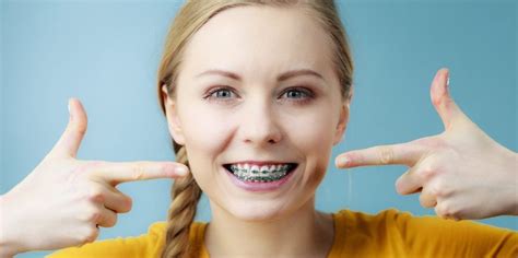 What To Do After Breaking A Bracket On Your Braces