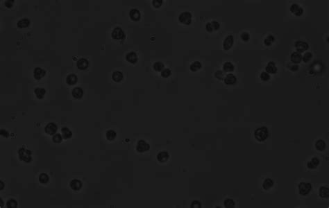 Yeastclassification Object Detection Dataset And Pre Trained Model By