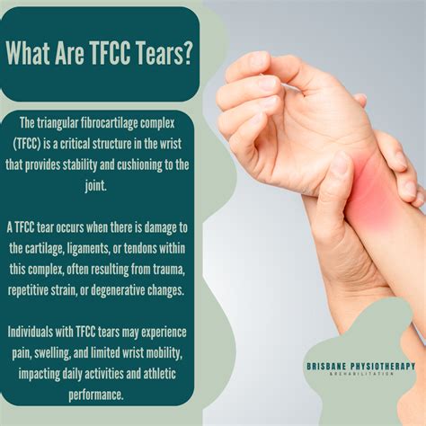 Tfcc Tear Triangular Fibrocartilage Complex Symptoms Treatment