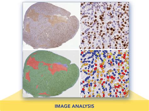 Histopathology Tissue Processing Services Seqmatic