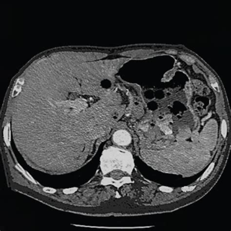 Comparison Of Reconstruction Effects Of Three Algorithms A Fdk