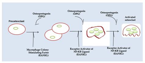 Carbonic Anhydrase Ii Activators In Osteopetrosis Treatment A Review