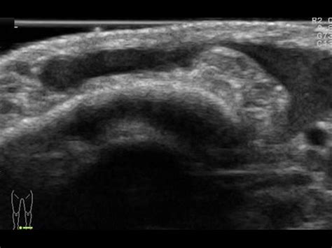 Musculoskeletal Joints And Tendons 68 Foot Case 684