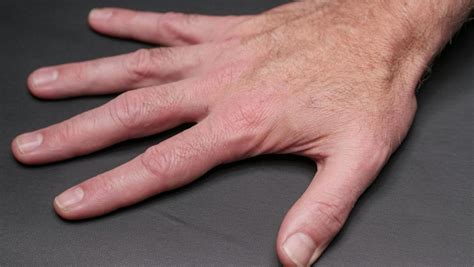 Doctor Explains What It Means If You Have Ridges On Your Fingernails