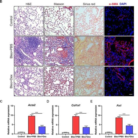 Dex Attenuates Pulmonary Fibrosis In Experimental Mice Models A