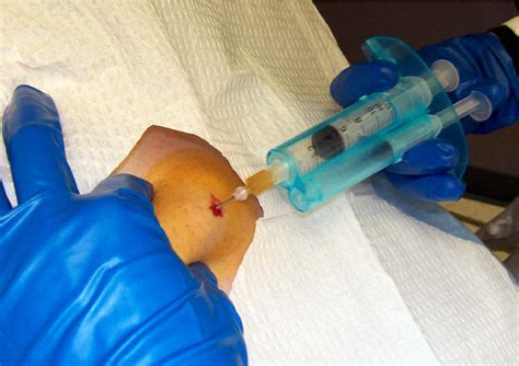 Is A Thyroid Biopsy Painful