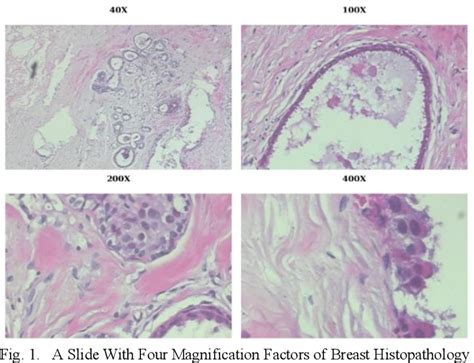 Figure 1 From Breast Cancer Detection On Histopathology Images Using Pre Trained Computer Vision