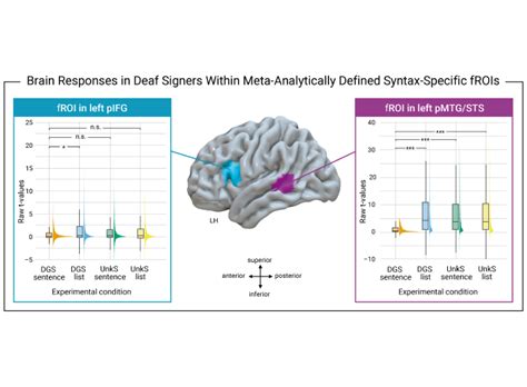 Modality Independent Core Brain Network For Language As Proved By Sign Language Patrick C