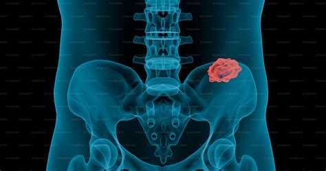 중간에 빨간 공이 있는 인간 골격의 X선 이미지 사진 Unsplash의 건강 상태 이미지