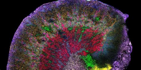 Developments In Maldi Imaging Technology Further Advance Clinical Research Separation Science