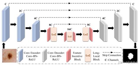 论文阅读rolling Unet，卷积结合mlp的图像分割模型 Ew帮帮网