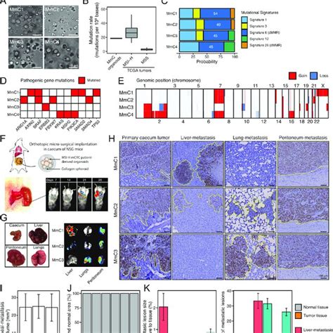 Mmc Organoids Recapitulate Genomic Characteristics Of Msi H Crc Tumors