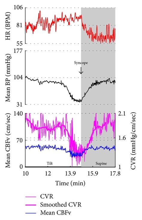 Cerebral Vasodilation During Syncope The Cerebral Vascular Resistance Download Scientific