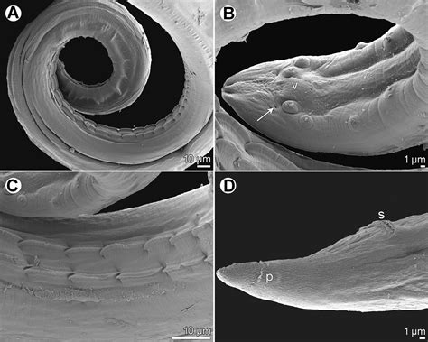 Redescriptions Of Spinitectus Acipenseri And S Micracanthus Nematoda Cystidicolidae With