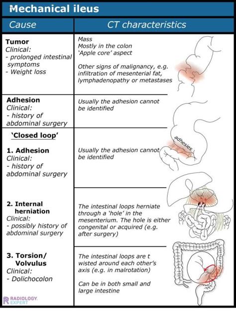Ct Abdomen General