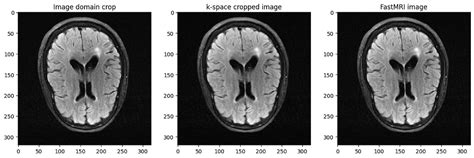 Visualising Mri Data In Python In This Post We Will See How To… By Nadav Levi Medium