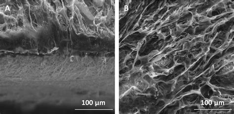 Figure 1 From Polylactidepolycaprolactone Asymmetric Membranes For Guided Bone Regeneration