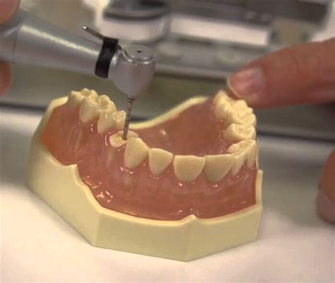 What Is Root Extraction Treatment Walnut Ranch Dental Spa