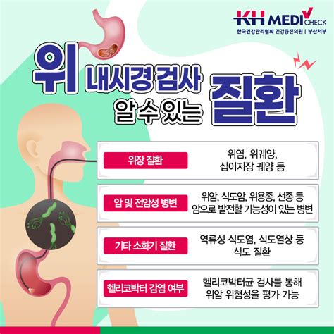 한국건강관리협회 부산서부지부 위내시경 검사로 알 수 있는 질환은 ️ 위염 위궤양 십이지장 궤양 등 각종 위장질환 ️ 위암 위용종 식도암 등 암 및 전암성 병변