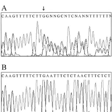 Electropherogram Section Showing The Exon 28 Opa1 2826delt Mutation Download Scientific