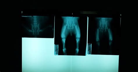 Radiographer Indian Systems Of Medicine Previous Question 110