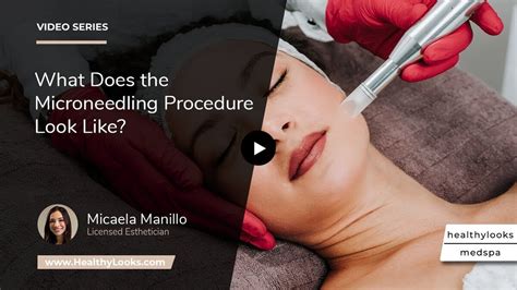 What Does The Microneedling Procedure Look Like Healthylooks Medspa