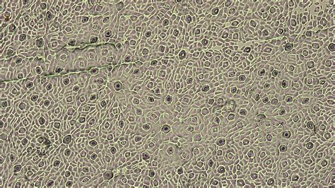 stomacounter object detection dataset and pre trained model by stomata