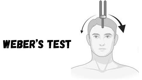 Webers Test Clinical Examination Ent Youtube