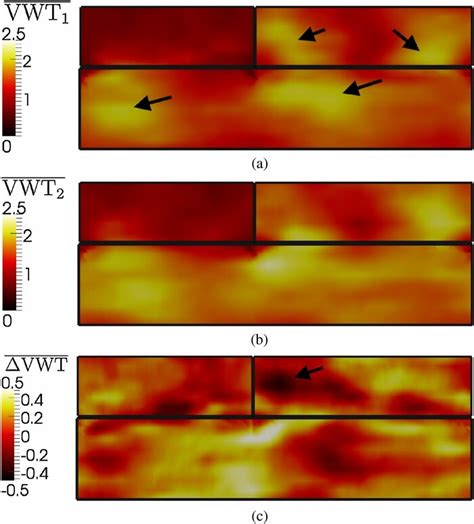 The Average 2D VWT And VWT Change Maps For The Placebo Group A The Download Scientific