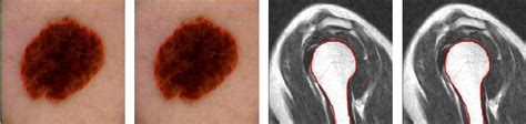 Eyegaze Segmentation Vs Mouse Segmentation For The Images Categorized