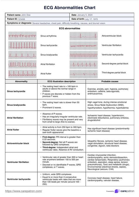 Abnormal Ecg Examples