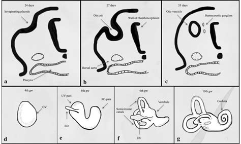 Schematic Description Of Inner Ear Development Transverse Section Download Scientific Diagram