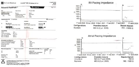 Device Trends Obtained At Interrogation Indicate A Large Increase In