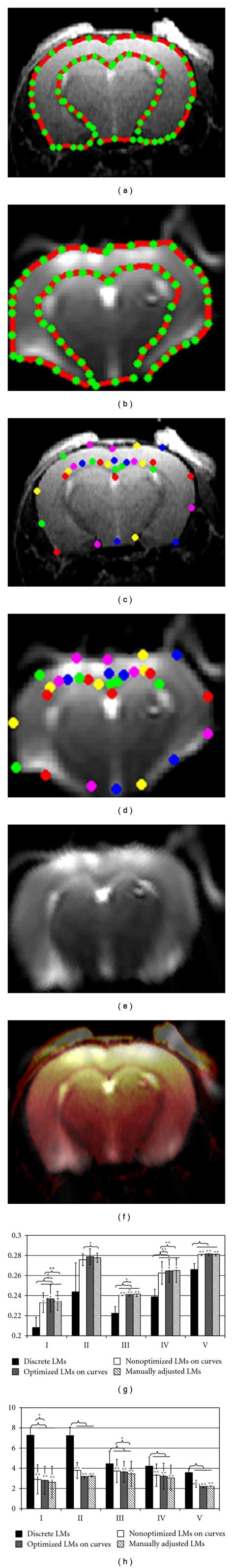 The Correction Of The Geometrical Distortion On A B0 Image A In Epi Download Scientific