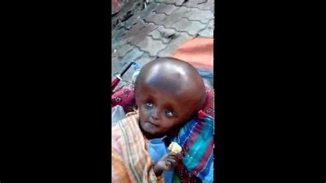 Do Asian Babies Have Bigger Heads At Bridget Huizenga Blog