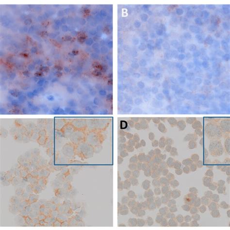 Subcellular Localization Of Flt3 Protein In Human Tonsil Tissue Aml