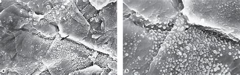 Figure 1 From The Key Role Of Corneocytes In Pityrosporoses Semantic Scholar