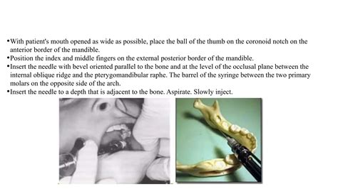 Trigeminal Nerve And Applied Anatomy Ppt