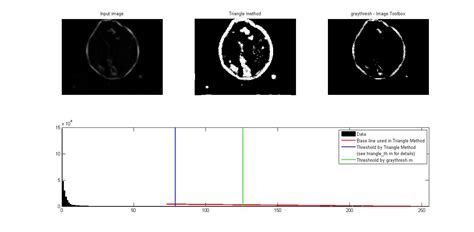 Matlab What Should Be The Ideal Thresholding Technique For Enhancing