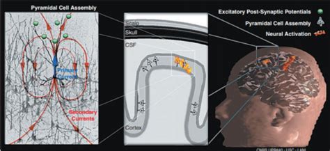 The Inverse Problem In Eeg Assumptions And Pitfalls Sapien Labs
