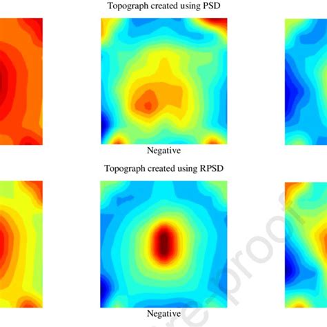 Rpsd And Psd Based Topographs Presenting The Variation Of Eeg Signals Download Scientific