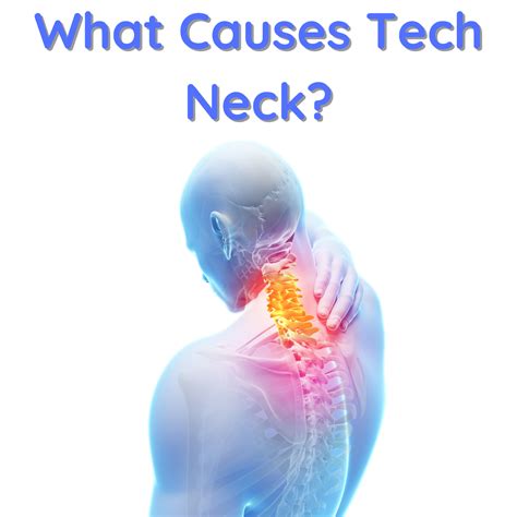 20 Effective Tech Neck Exercises Free Printable Checklist My