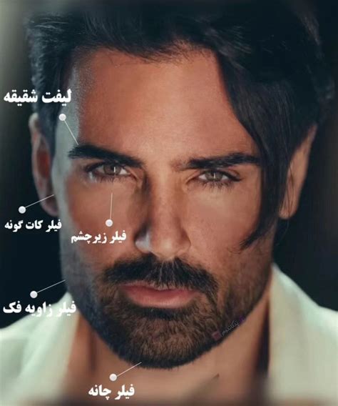 عکس تغییرات اساسی در چهره سهراب‌ پاکزاد بعد از عمل زیبایی خبرآنلاین