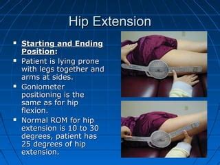 Hip Goinomery Ppt