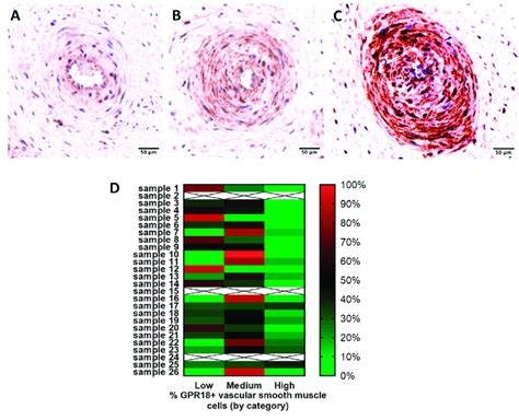 Gpr 18 Expression In Placental Vascular Smooth Muscle Low A Medium