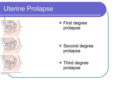 Common Disorders Of Male Female Reproductive Systems Ppt Sept 2006 Ppt