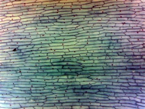 Plant Cell Nucleus Microscope