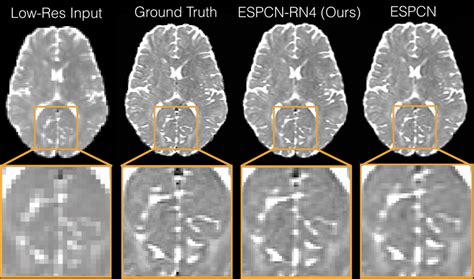 A Visualisation Of Mean Diffusivity Maps On An Axial Slice On A Test Download Scientific