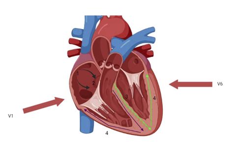Bundle Branch Block Lbbb Rbbb Geeky Medics