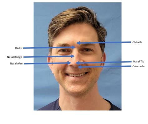 Different Parts Of A Person S Nose They Want Changes Dr Reilly